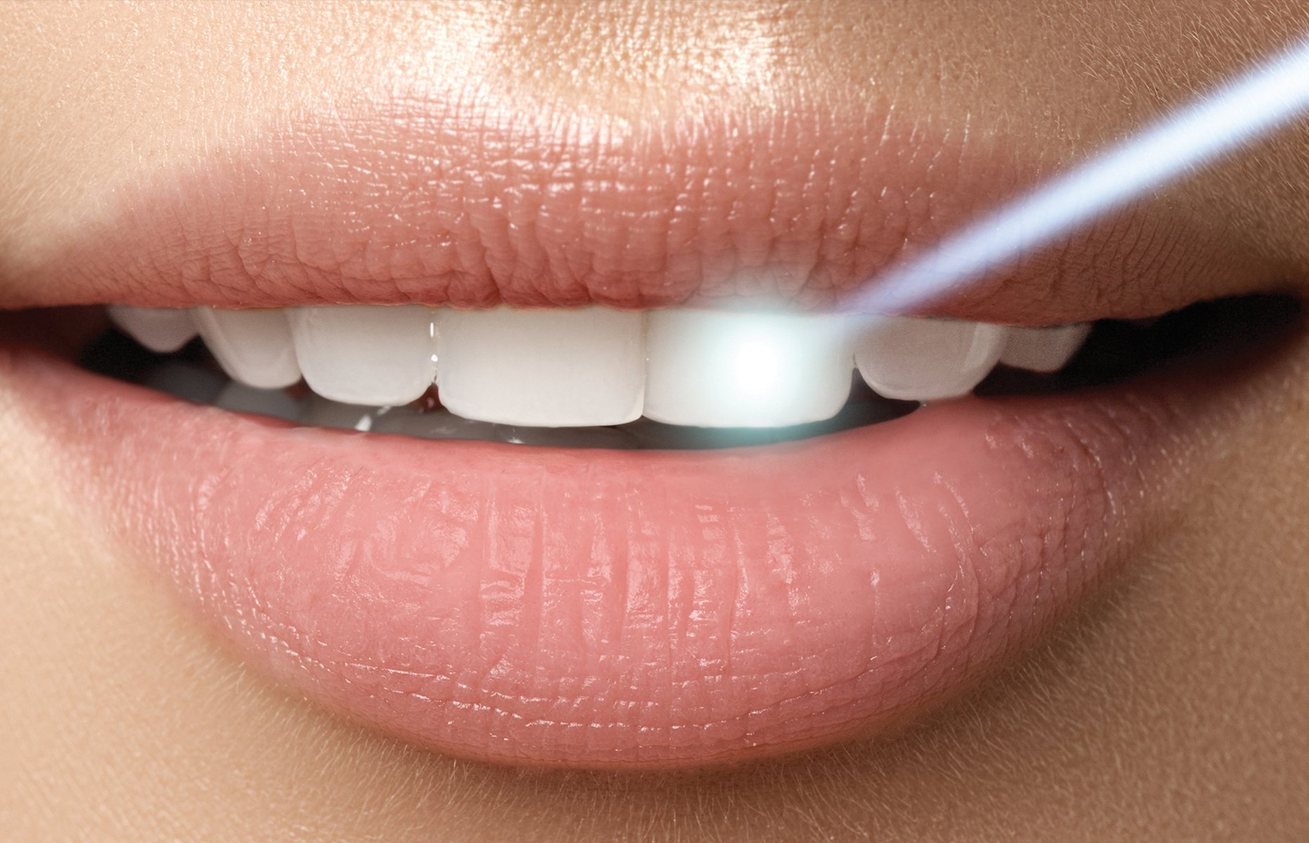 All-tissue Dental Surgery - Access Laser